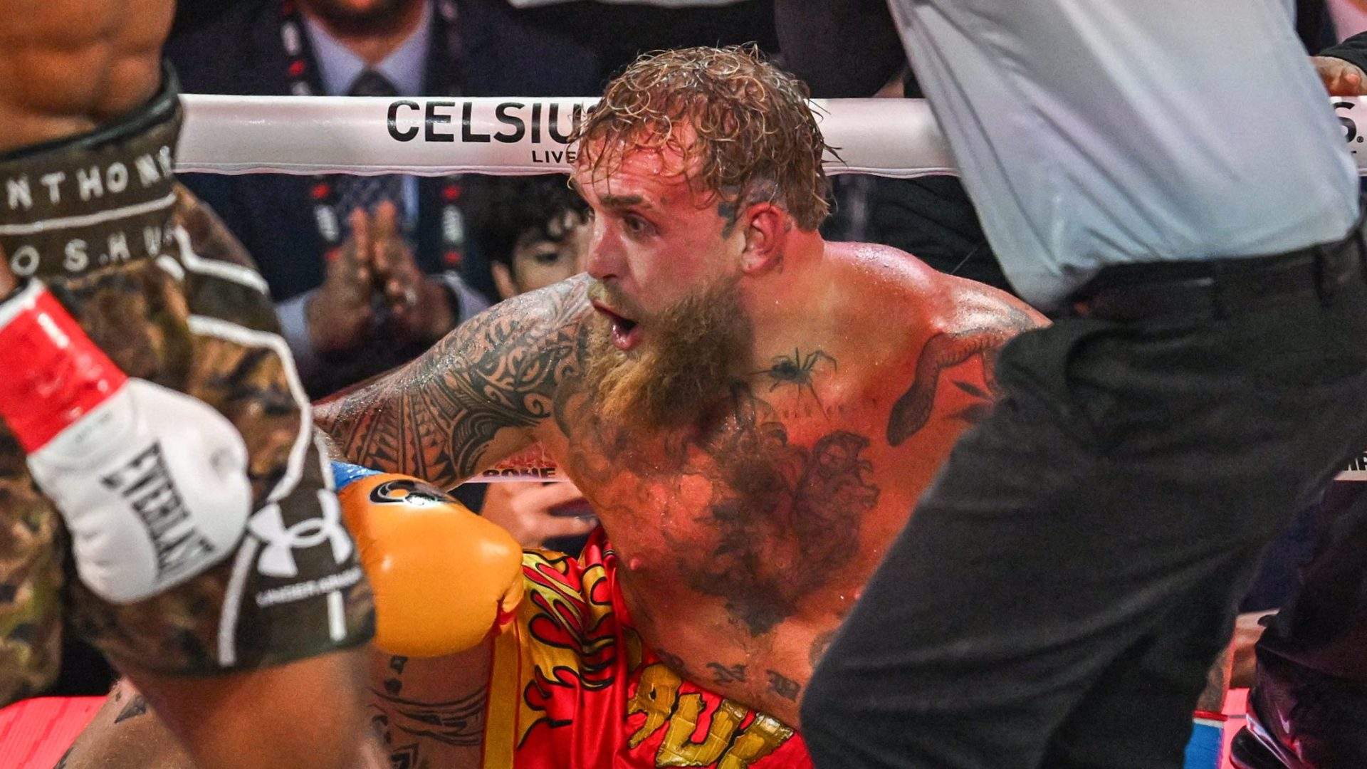 Paul Posts X-Ray Showing Brutal Injury After KO Loss to Joshua - HEAVY