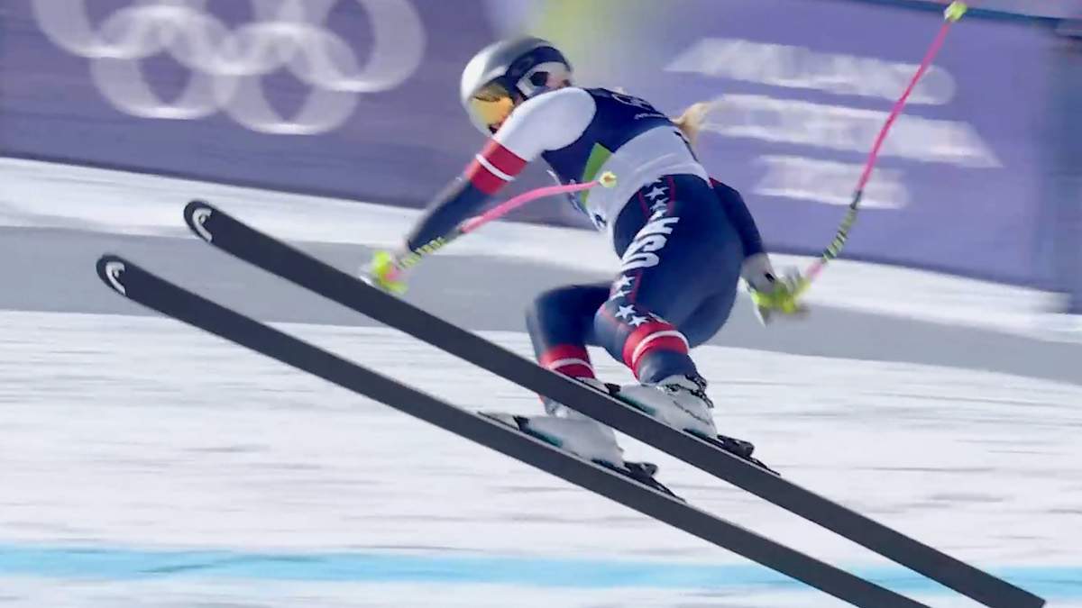 Lindsey Vonn Has 2nd Surgery as Father Calls For Her Retirement