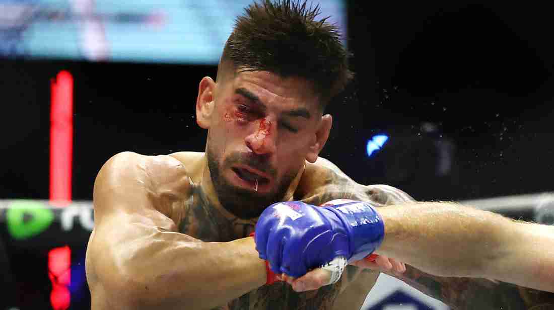 Ilia Topuria Injury Update Reveals Damage From Justin Gaethje